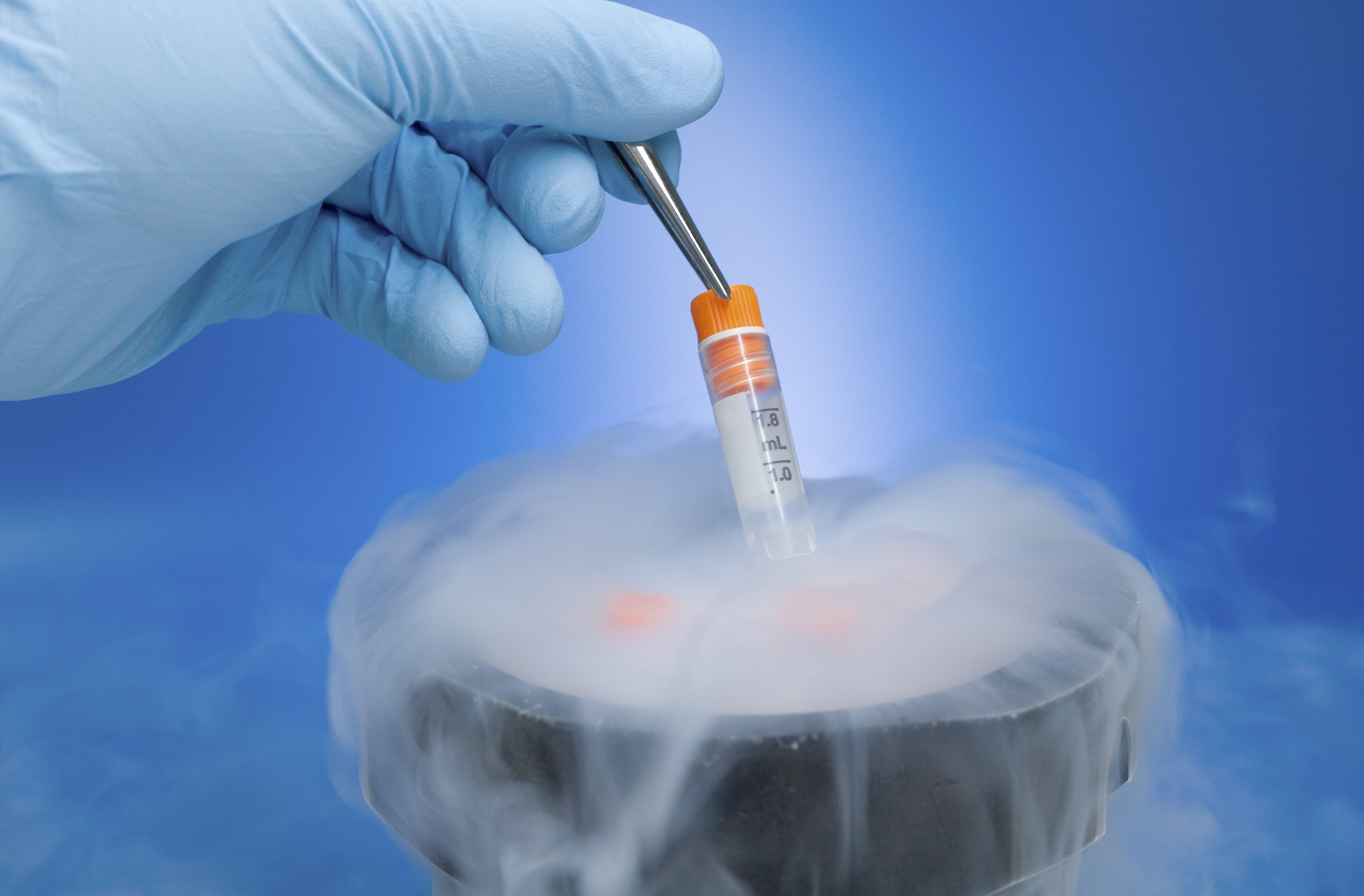From Dr. Paul Gindoff of Chelsea Fertility NYC: